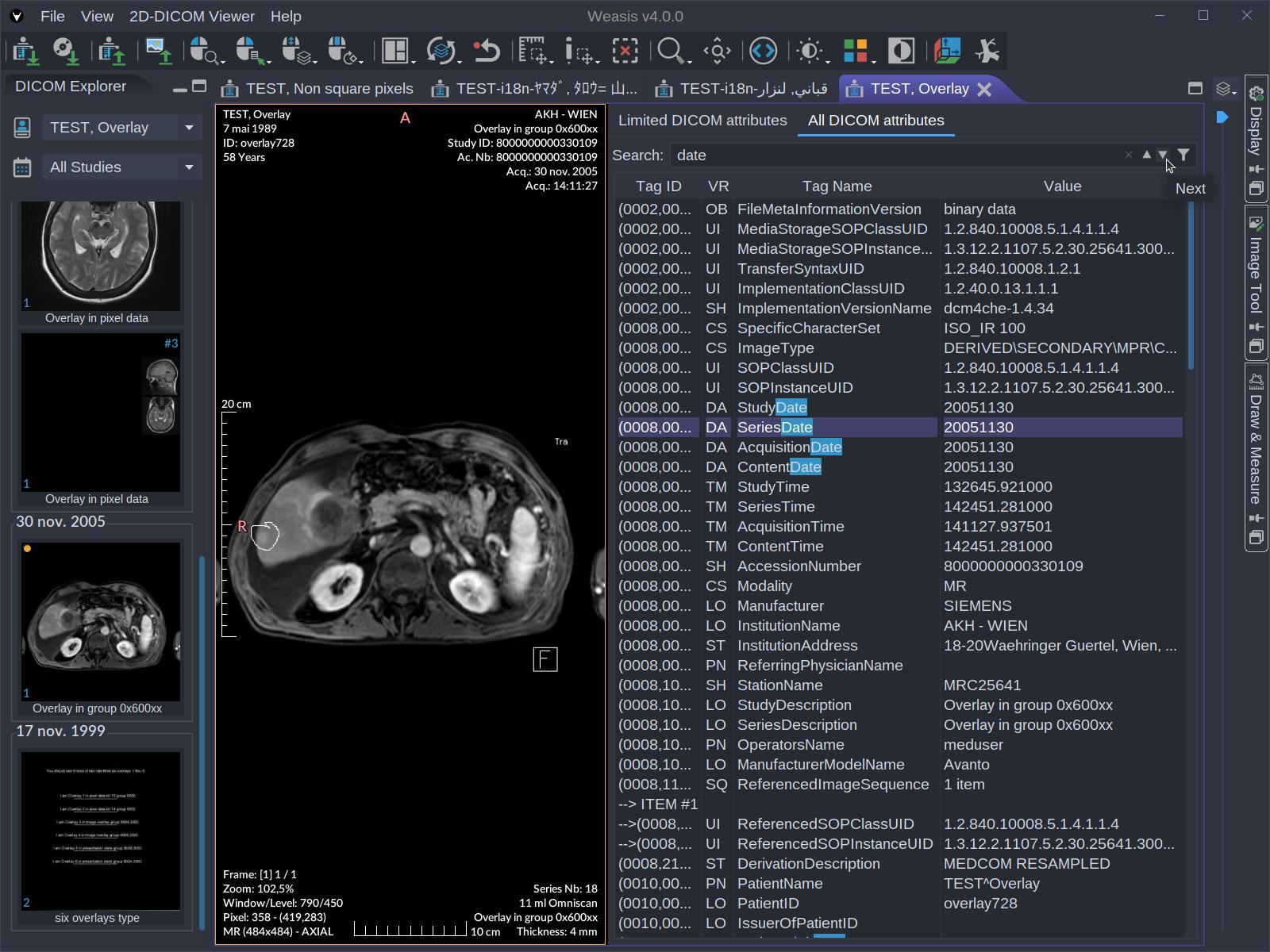 Weasis: Free DICOM viewer :: Weasis Documentation